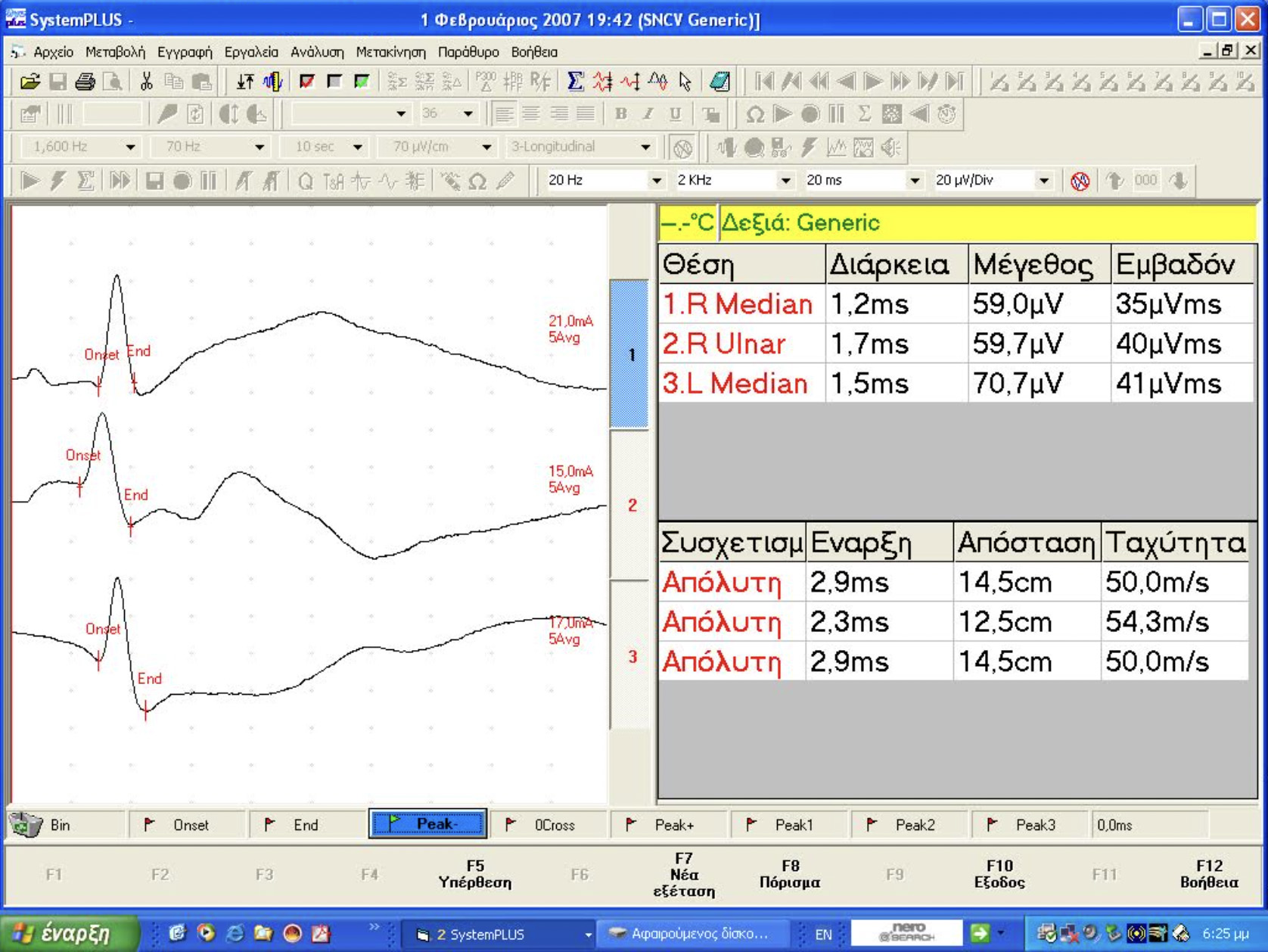 neurofysiologia - Ηλίας Τσορλίνης